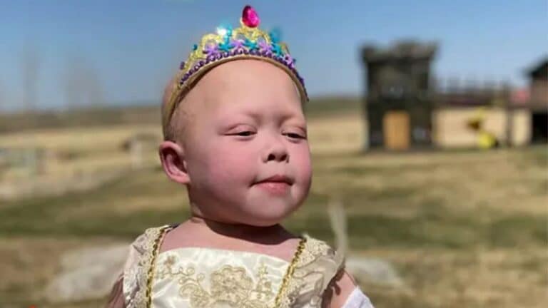 TikTok's Bella Brave Dies at 10 After Battling Rare Health Issues